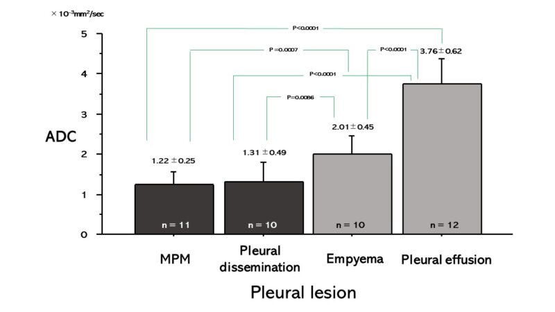 PLEURAL LESION INCLUDING MALIGNANT PLEURAL MESOTHELIOMA | usuda-mri